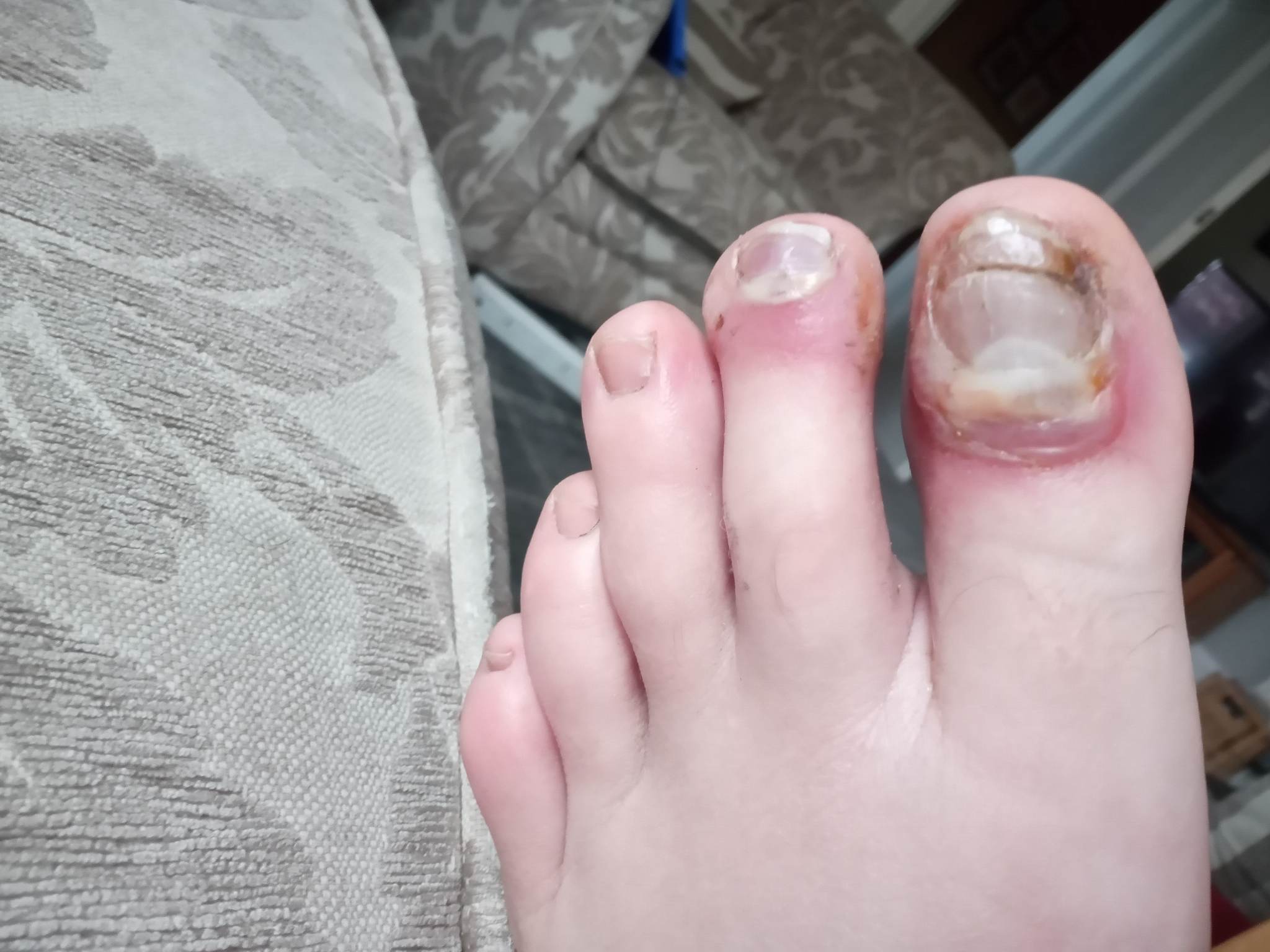 Thames Ring 250 – Miles Together